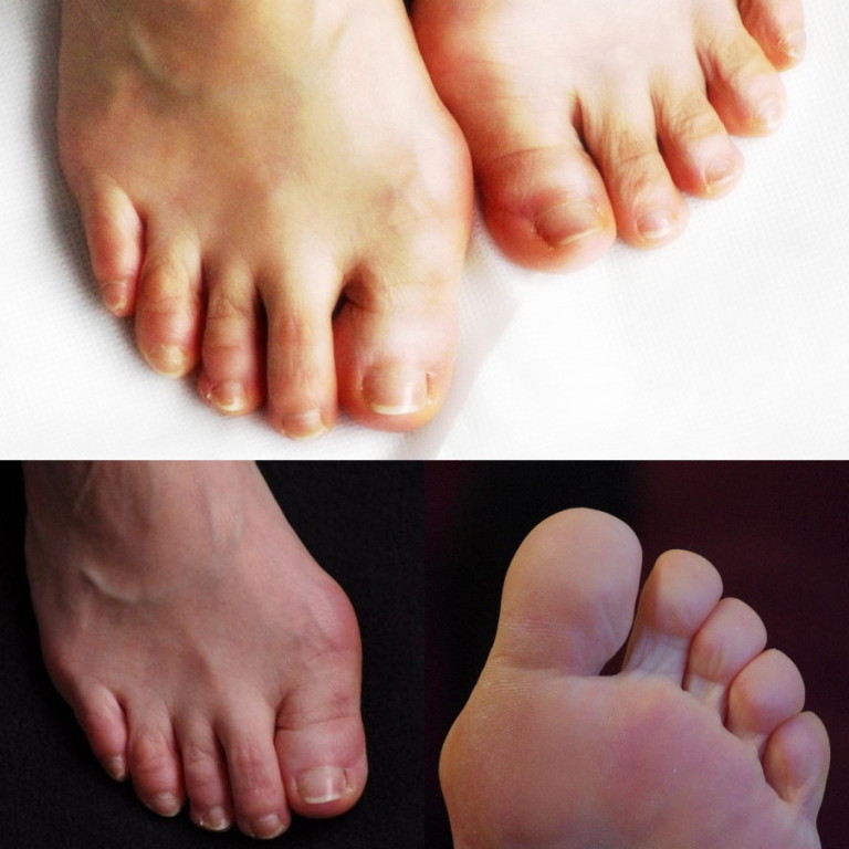 "Die Sprache der Zehen" übersetzt - Alles rund ums Zehenlesen - Die ...